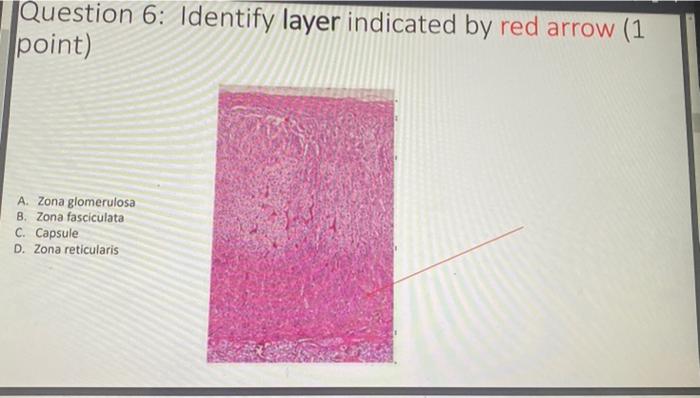Solved Question 5: Identify the slide (1 point) A. Pancreas | Chegg.com