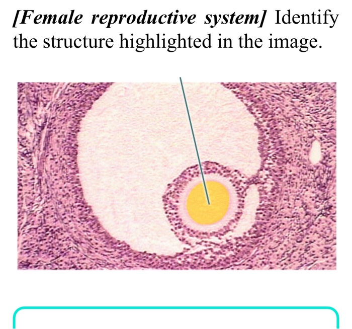 Solved [Female reproductive system] Identify the structure | Chegg.com