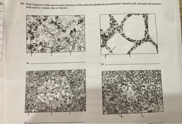 Solved 9. Four diagrams of the microscopic structures of the | Chegg.com