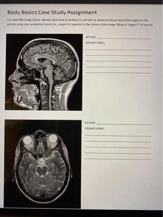 Solved Body Basics Case Study Assignment For each MRI image | Chegg.com