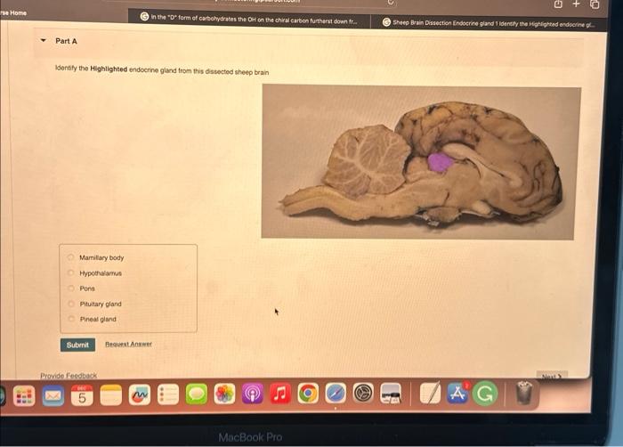 Solved Identify the Highlighted endocrine gland from this | Chegg.com