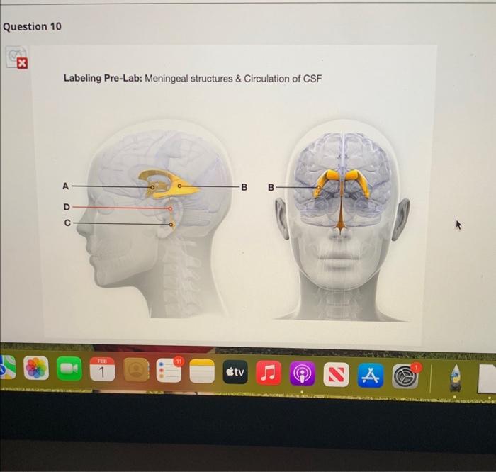 Solved Labeling Pre-Lab: Meningeal structures \& Circulation | Chegg.com