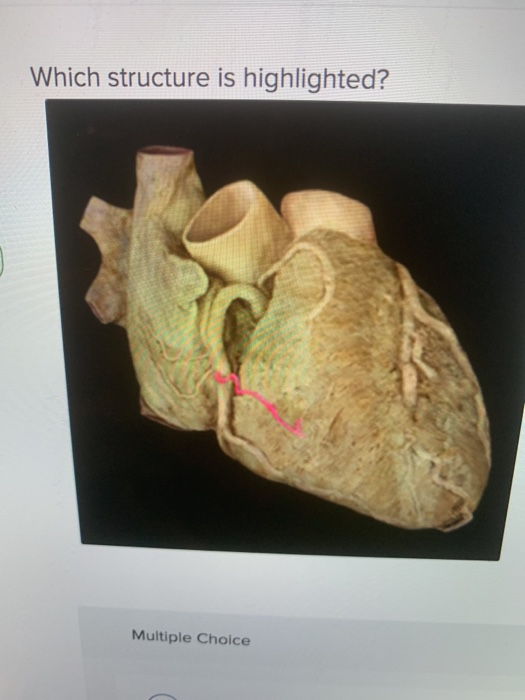 Solved Which structure is highlighted? Multiple Choice | Chegg.com