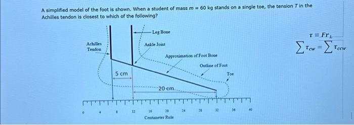 Solved A simplified model of the foot is shown. When a | Chegg.com