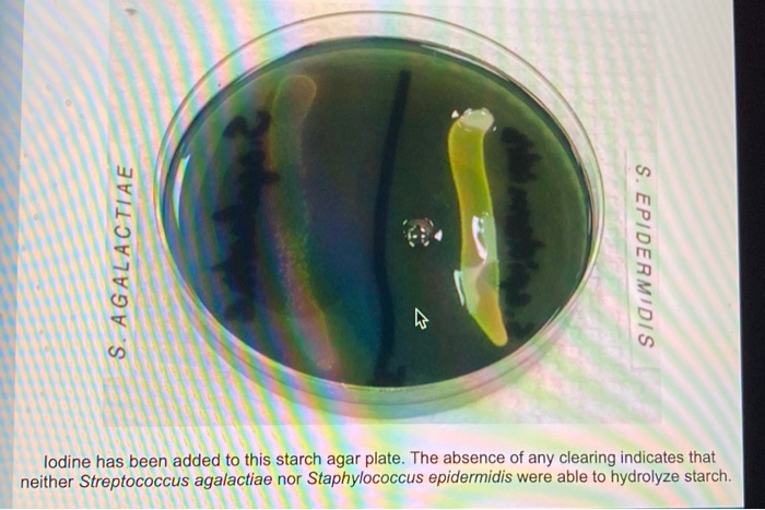 Solved Starch Hydrolysis Starch agar is a differential | Chegg.com
