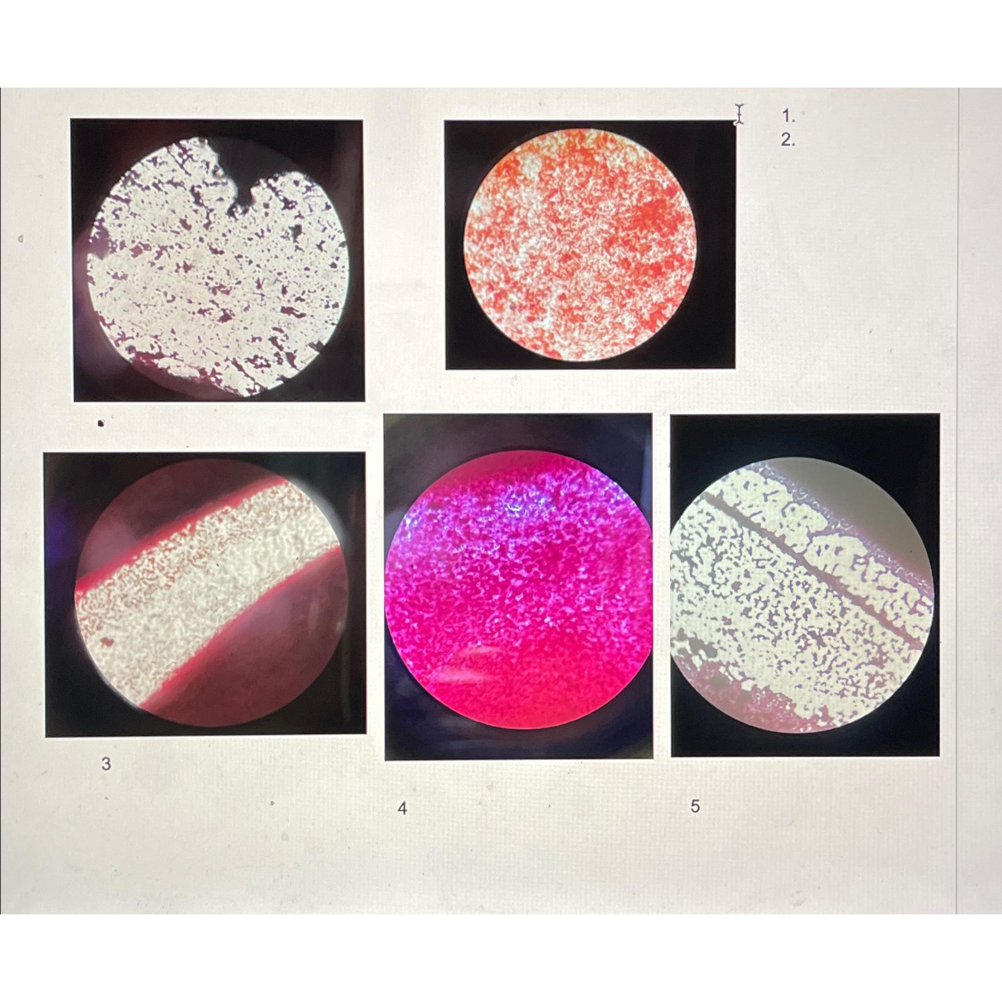 Solved These are the gram stains of bathroom door handles | Chegg.com