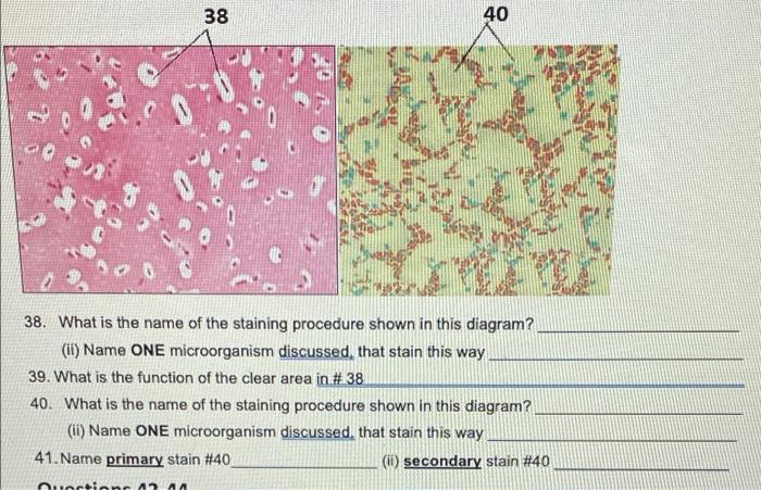 Solved 38 40 00 38. What is the name of the staining | Chegg.com