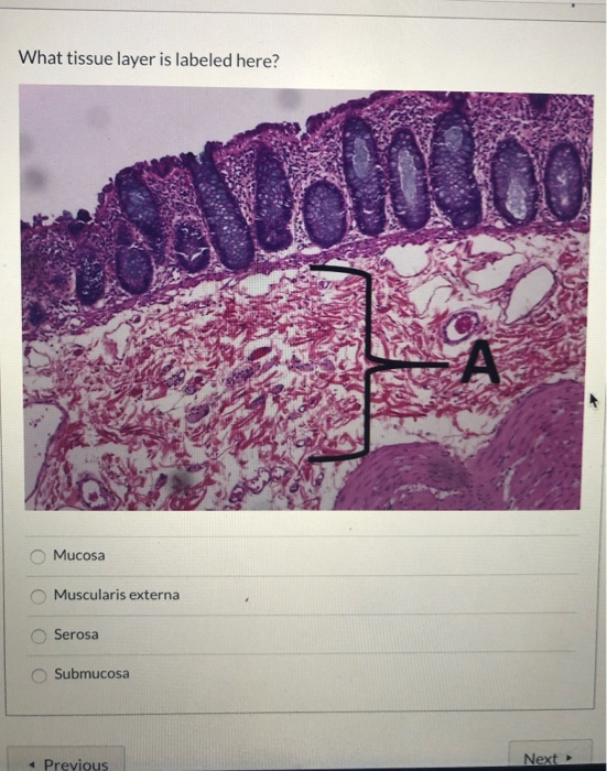 Solved What tissue layer is labeled here? O Mucosa O | Chegg.com