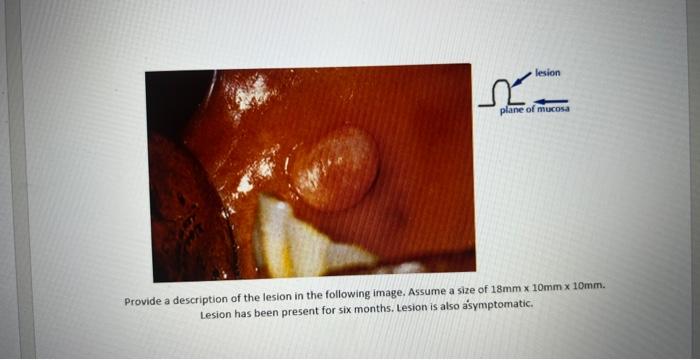 Solved Provide a description of the lesion in the following | Chegg.com