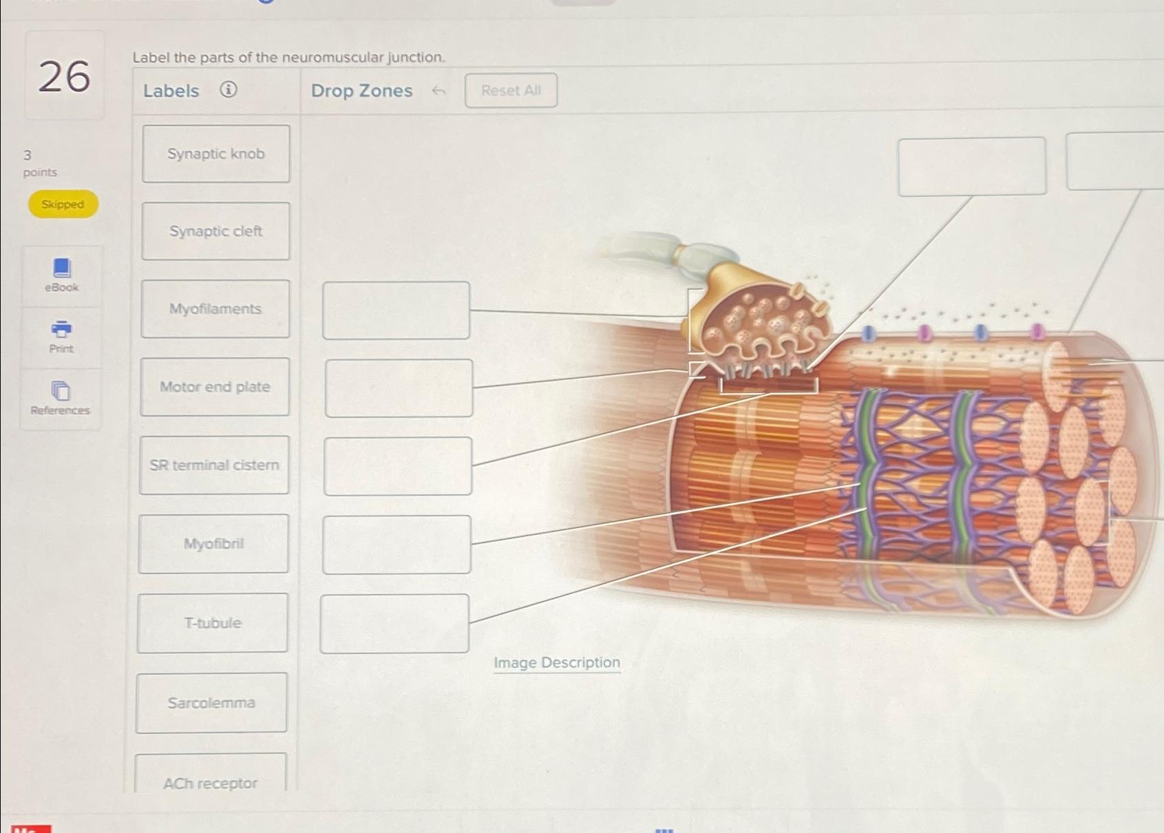 Solved 26Label the parts of the neuromuscular junction. | Chegg.com
