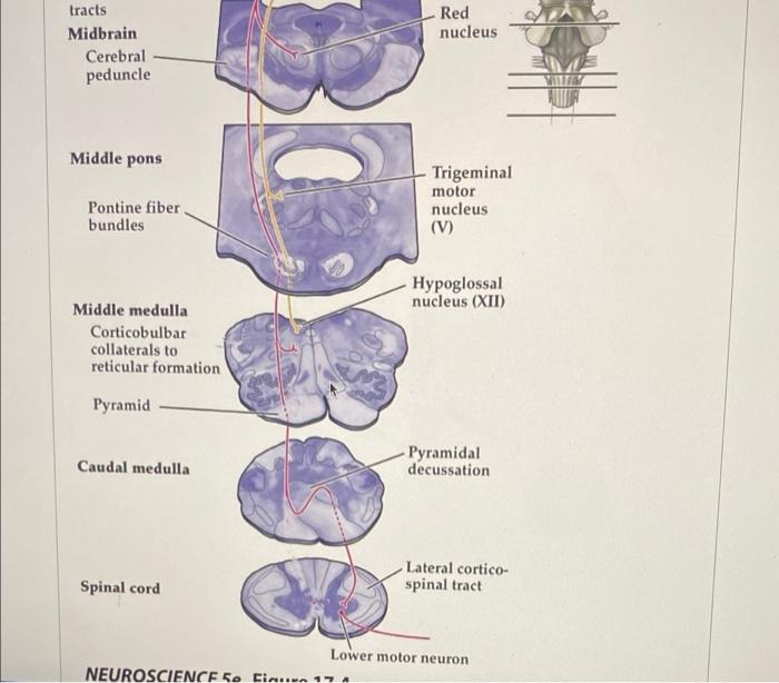 Solved The figure shows the anterior surface of the | Chegg.com