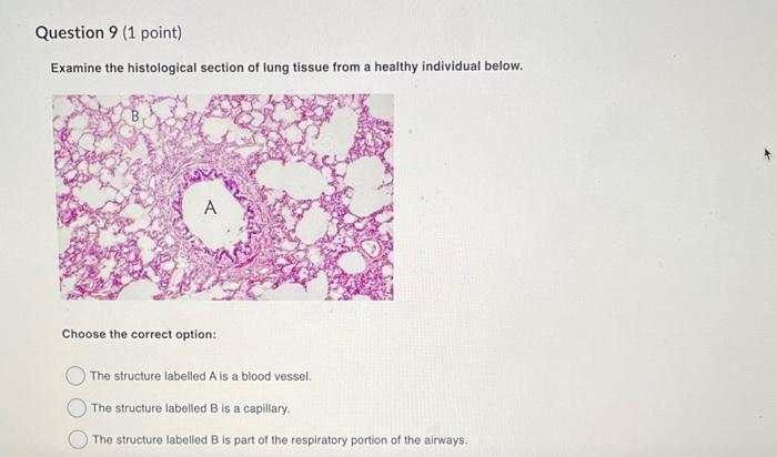 Solved Below is a Spirograph from a patient who has | Chegg.com