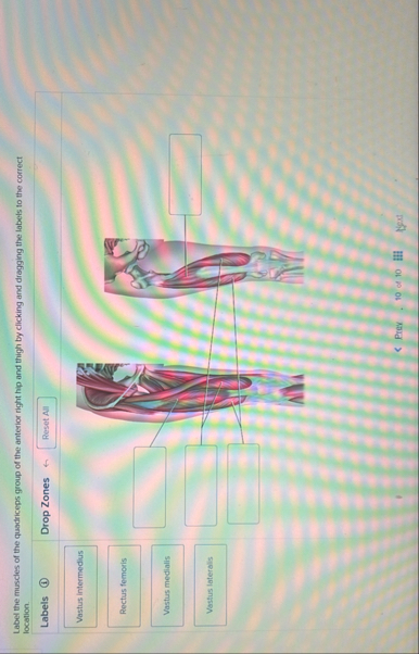 Solved Label the muscles of the quadriceps group of the | Chegg.com