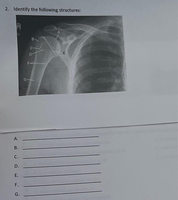 Solved 2. Identify the following structures: A. B. C. D. | Chegg.com