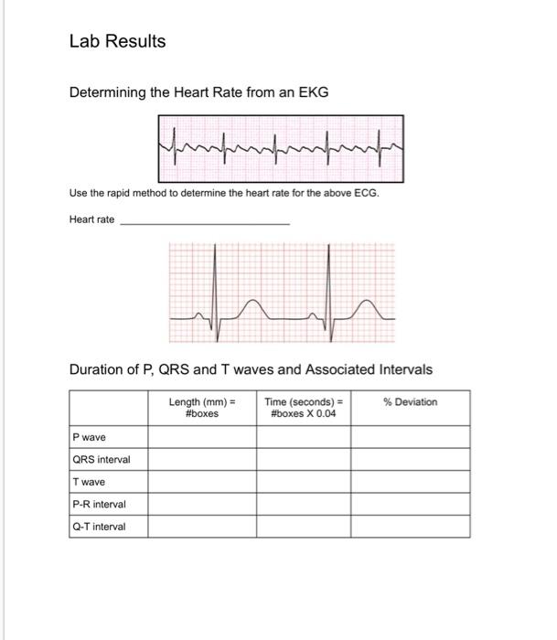 Solved Determining the Heart Rate from an EKG Use the rapid | Chegg.com
