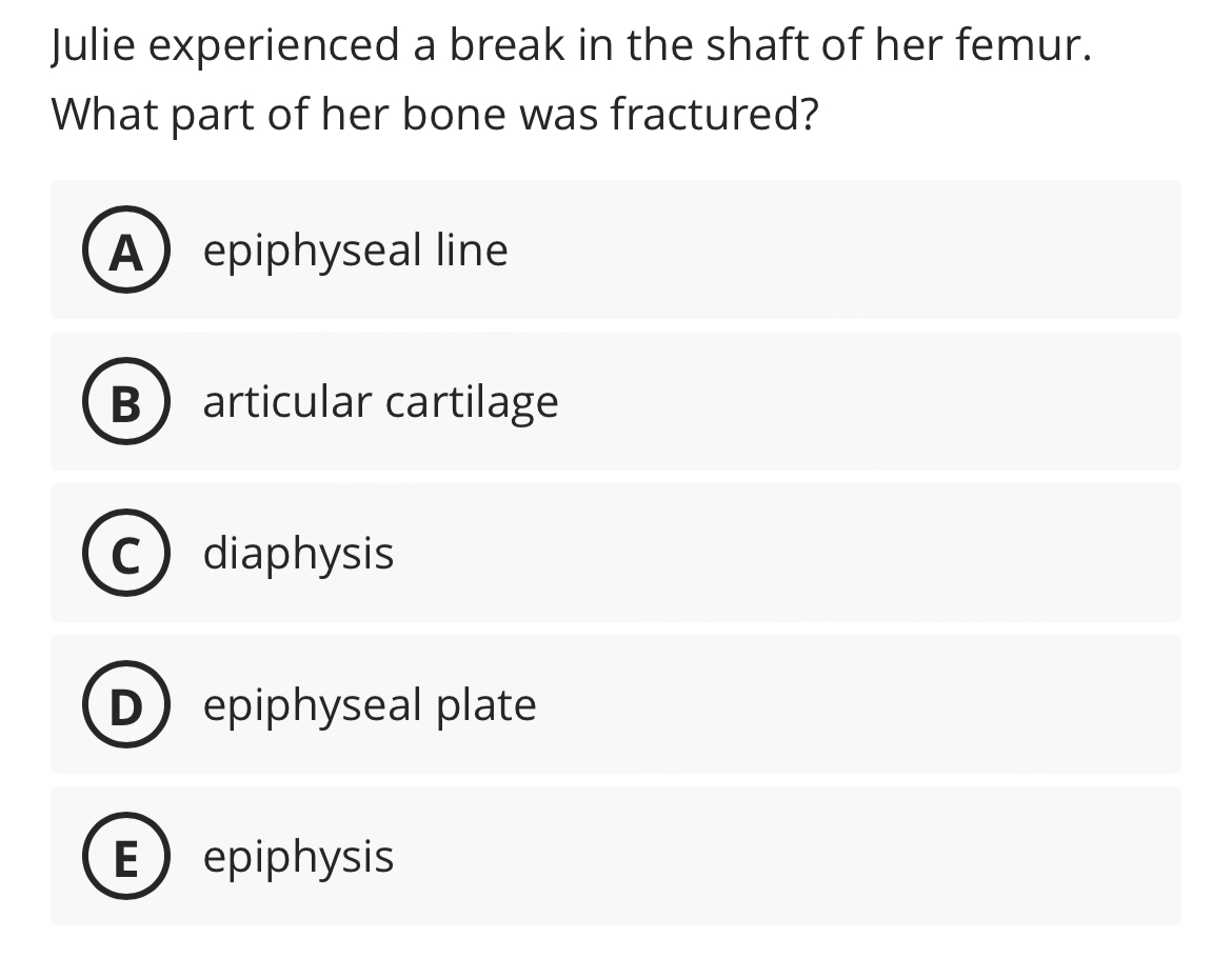 Solved Julie experienced a break in the shaft of her | Chegg.com
