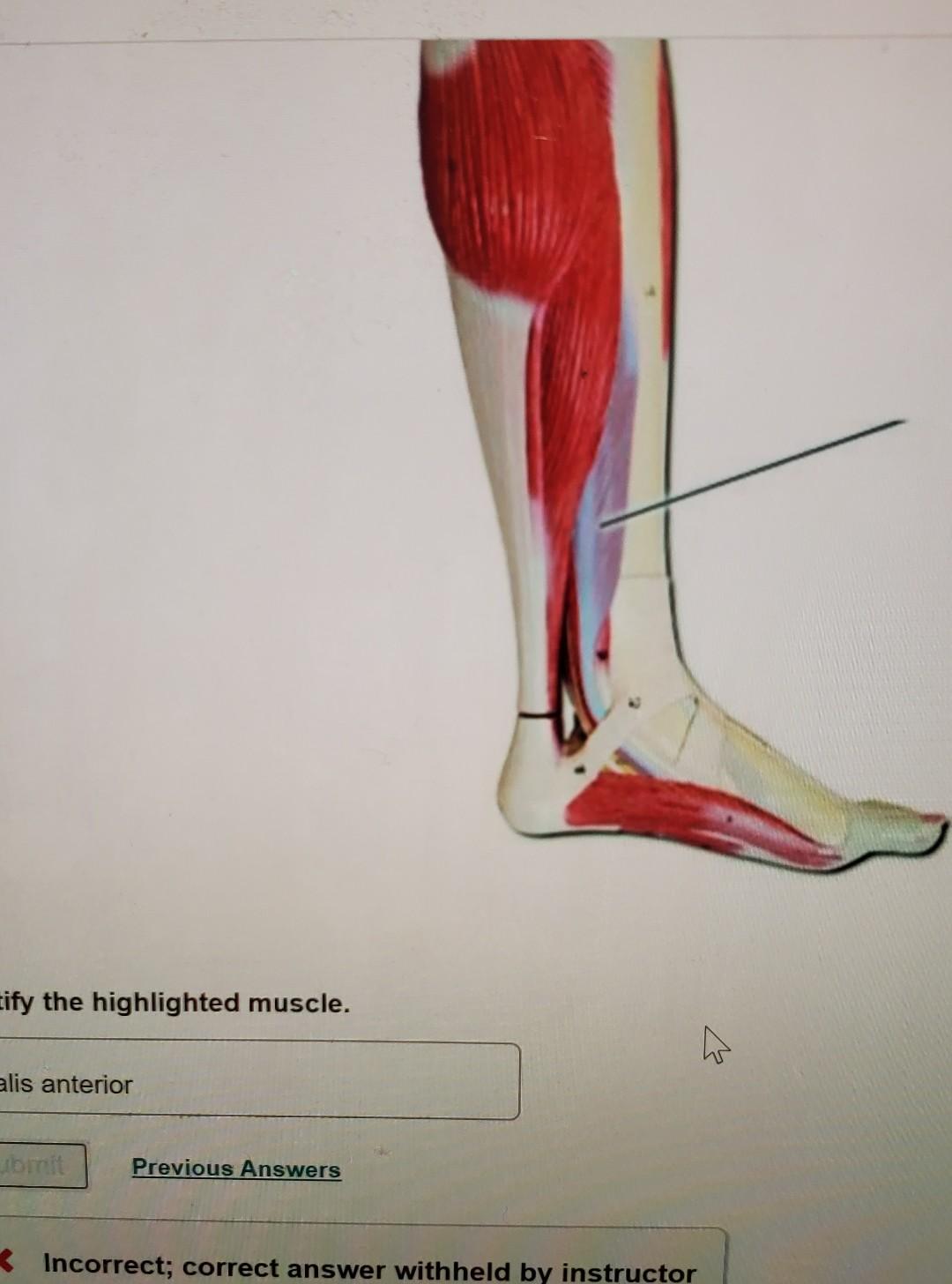 Solved tify the highlighted muscle. Ť & alis anterior ubmit | Chegg.com