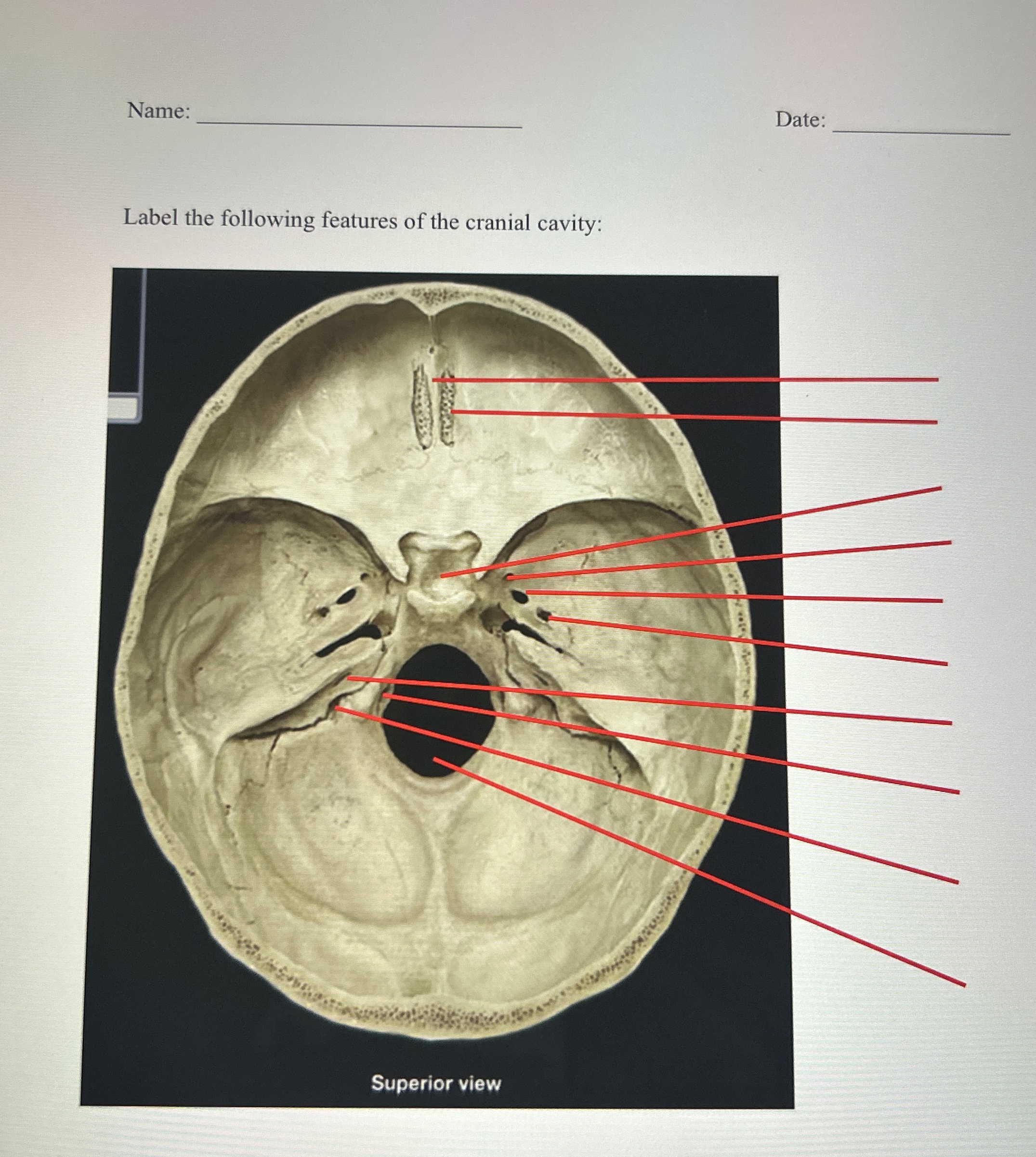 Solved Label the following features of the cranial cavity | Chegg.com