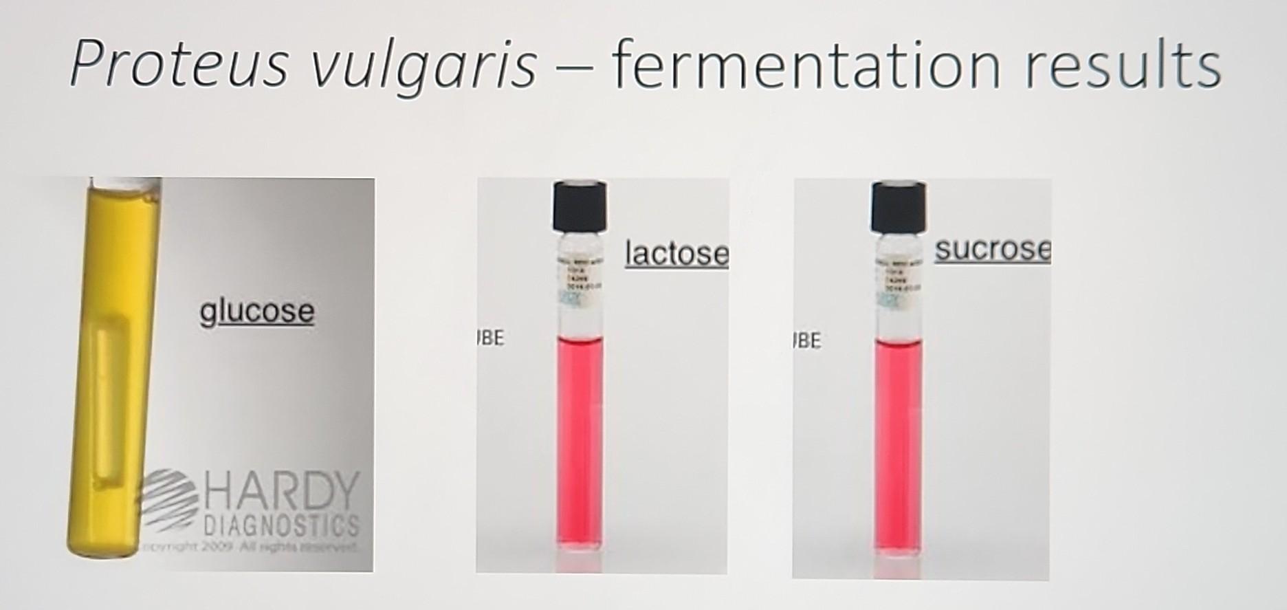 Solved Alcaligenes faecalis - fermentation | Chegg.com
