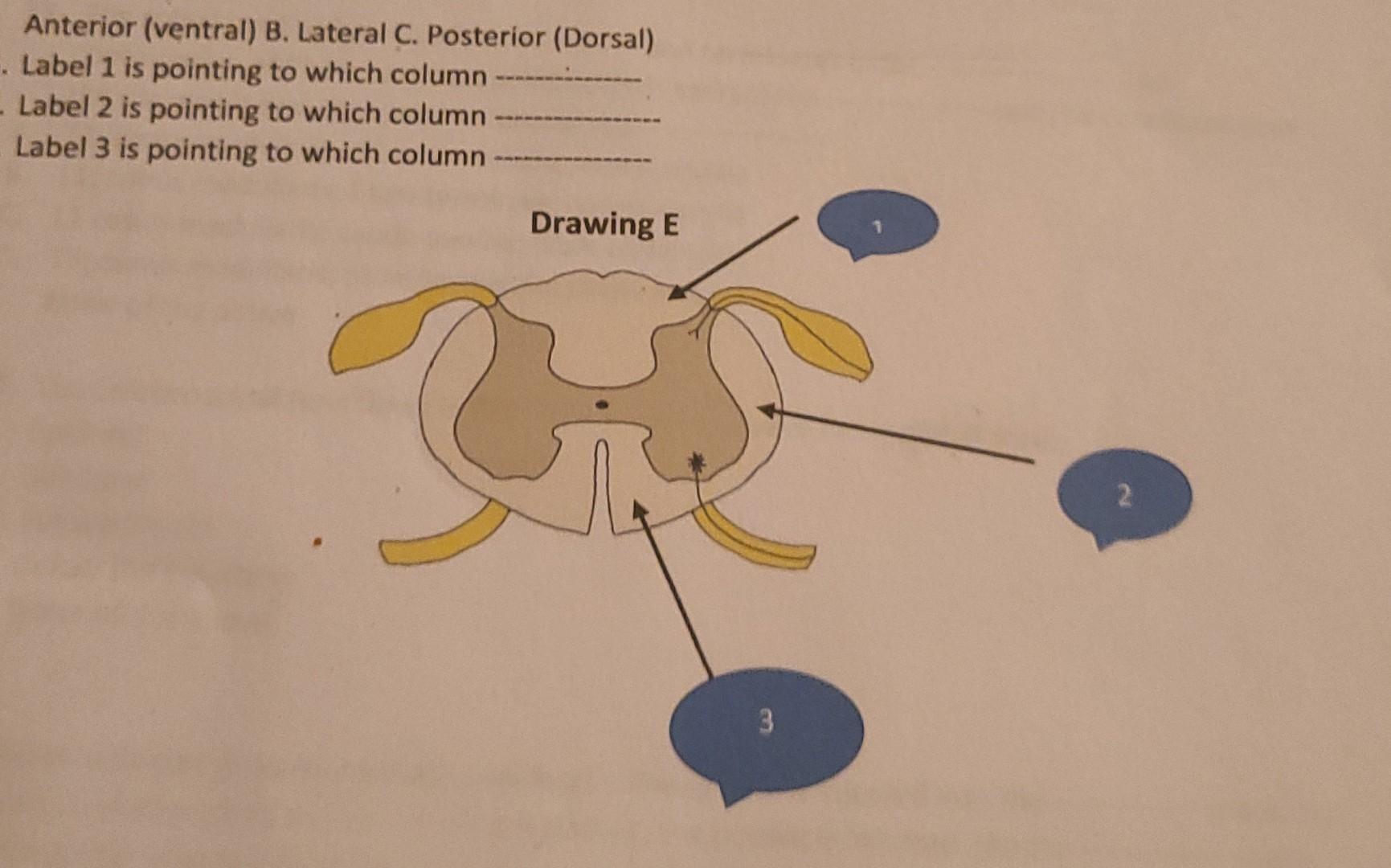 Solved Anterior (ventral) B. Lateral C. Posterior (Dorsal) | Chegg.com