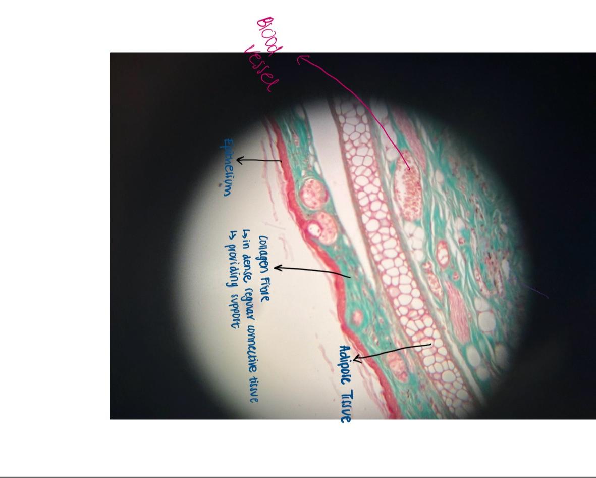 Solved This is a diagram of a masson trichromate stain on an | Chegg.com