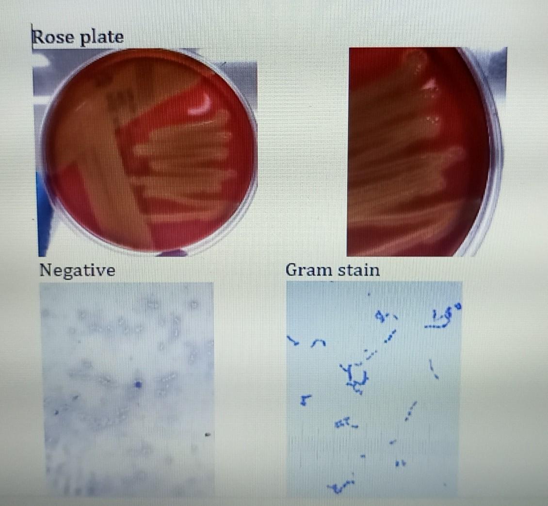 Rose plate Wild Negative Gram stain . Catalase | Chegg.com