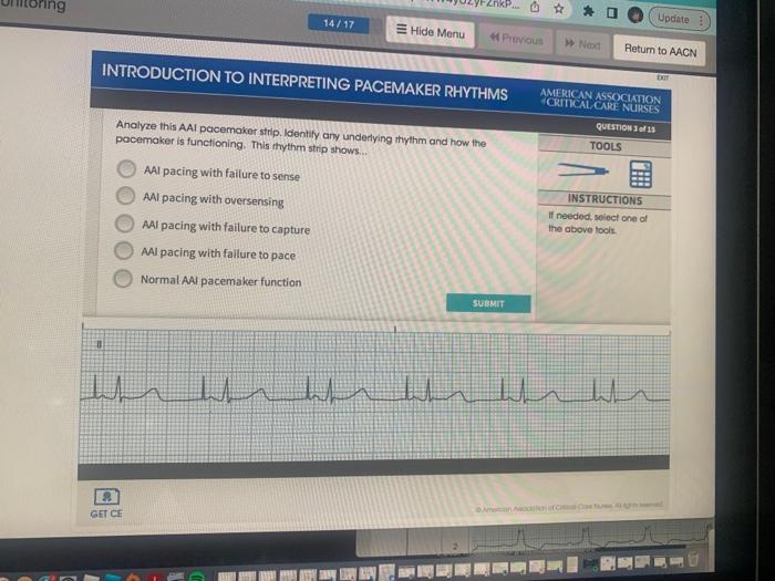 Solved Analyze this AAl pacemaker stip. Identity ary | Chegg.com