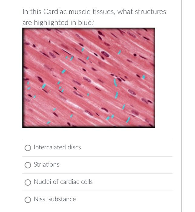 Solved In this Cardiac muscle tissues, what structures are | Chegg.com