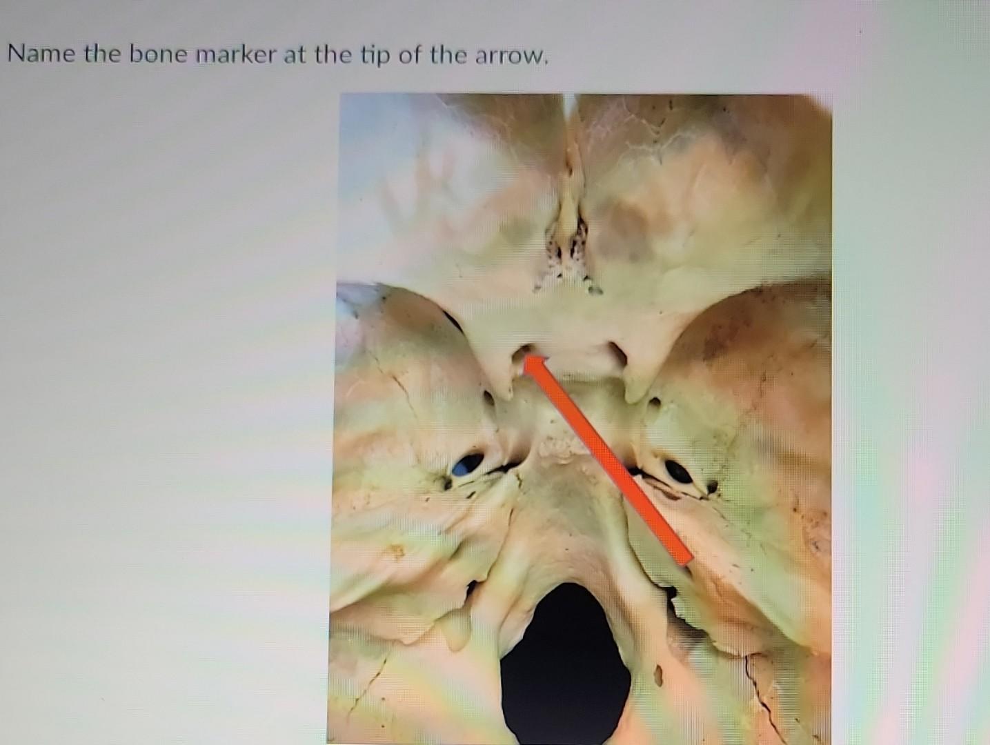Solved Name the bone marker at the tip of the arrow. Name | Chegg.com
