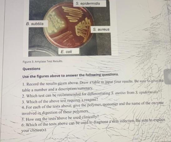 Solved B. subtilis S. epidermidis S. aureus Figure 1. DNase | Chegg.com
