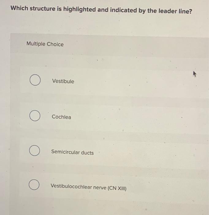 Solved Anterior Posterior Which structure is highlighted | Chegg.com