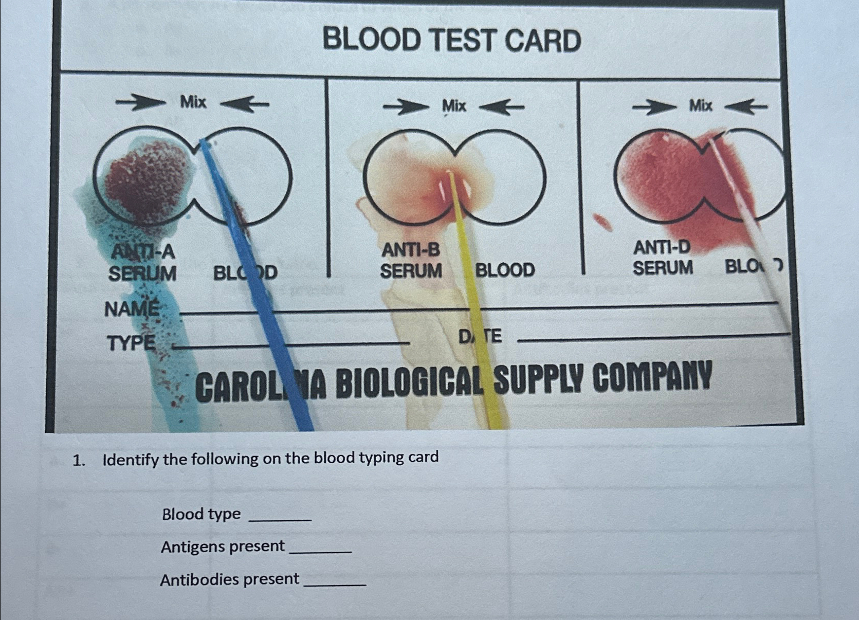 Solved BLOOD TEST CARDIdentify the following on the blood | Chegg.com