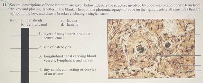 Solved 11. Several descriptions of bone structure are given | Chegg.com