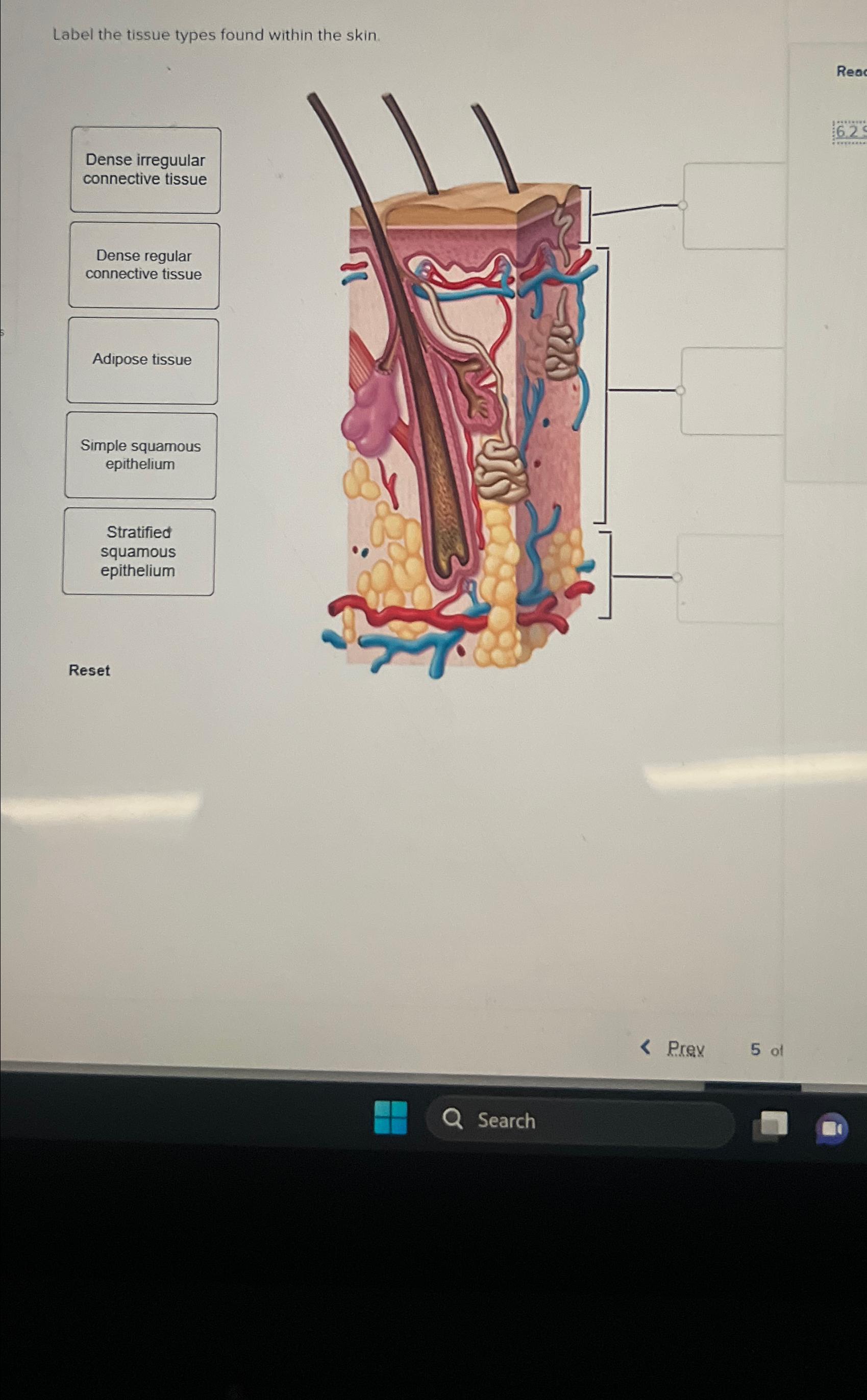 Solved Label the tissue types found within the skin.Prev5 | Chegg.com