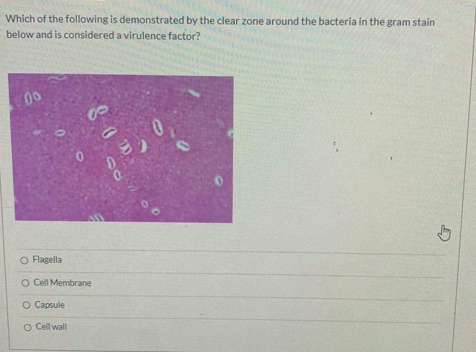 Solved An example of an Exoenzyme that can be easily tested | Chegg.com