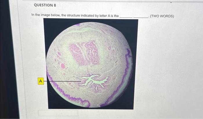 Solved In the image below, the structure indicated by letter | Chegg.com