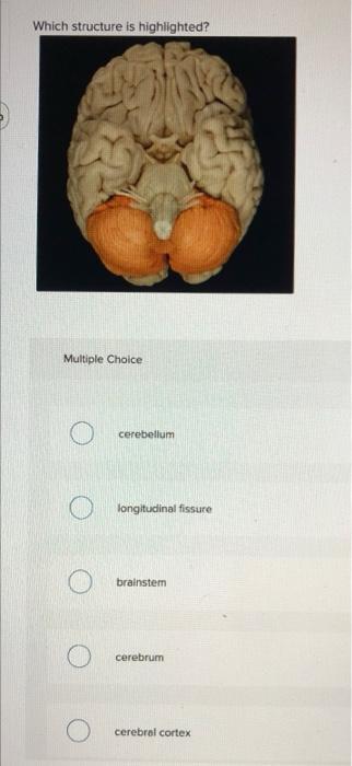 Solved Which structure is highlighted? Multiple Choice | Chegg.com