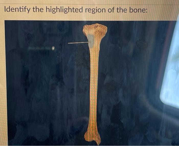 Solved Identify the highlighted bone: Identify the | Chegg.com