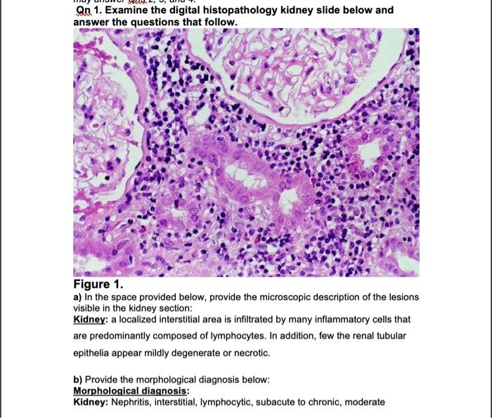 Solved An 1. Examine the digital histopathology kidney slide | Chegg.com