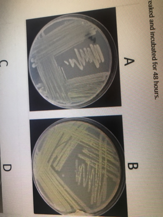 Solved Streak Plate Technique Plates were streaked and | Chegg.com