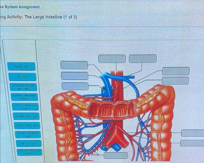 Solved re System Assignment ing Activity: The Large | Chegg.com