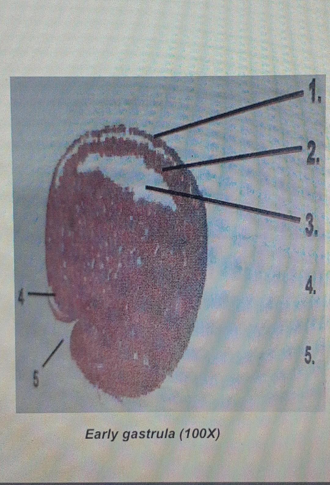 Solved 1. 2. 4. དུ Early gastrula (100X) | Chegg.com