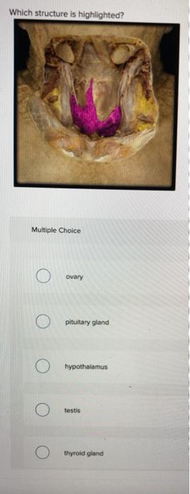 Which structure is highlighted? Multiple Choice ovary | Chegg.com