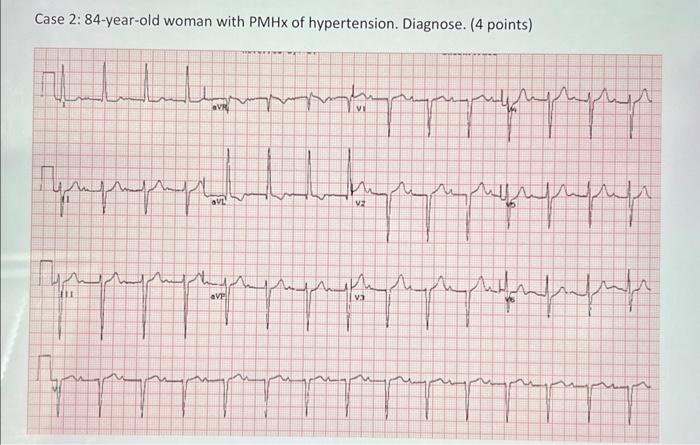 Solved Case 1: 48-year-old man with PMHx of diabetes. | Chegg.com