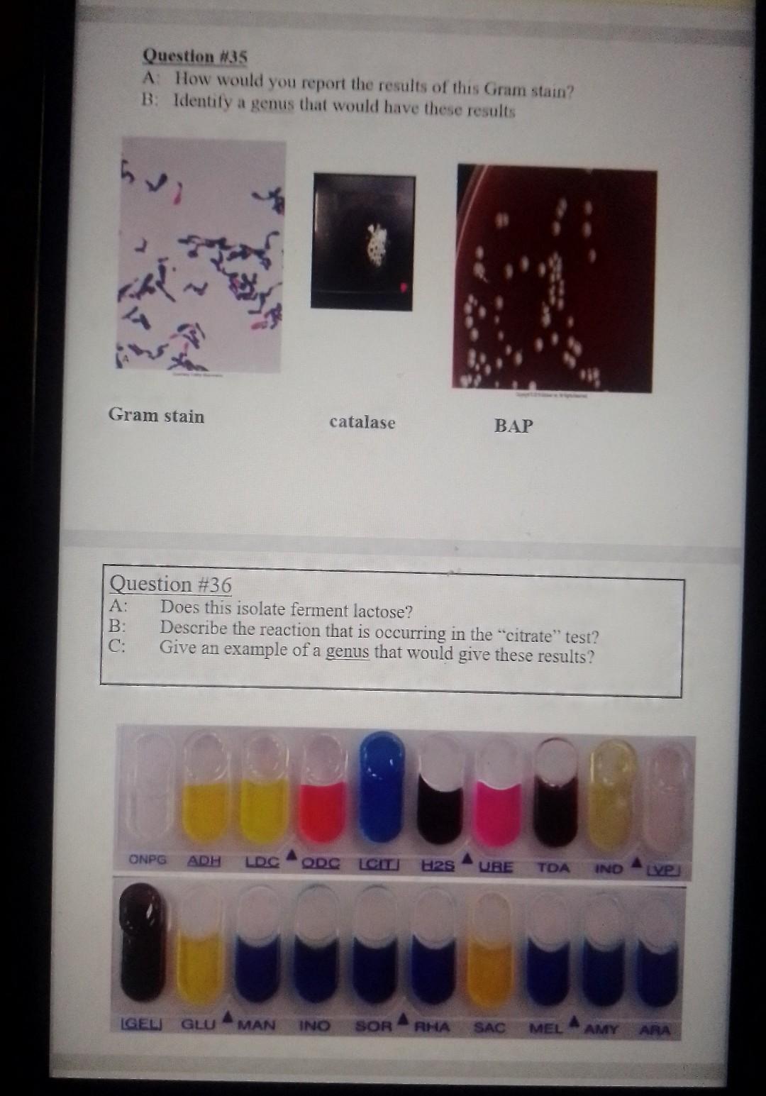 Solved Question 835 A: How would you report the results of | Chegg.com
