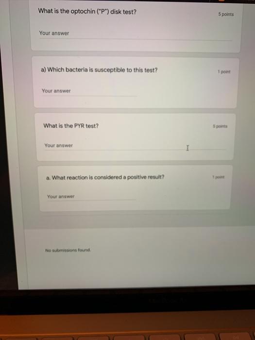 Solved What is the optochin ("P") disk test? 5 points Your | Chegg.com