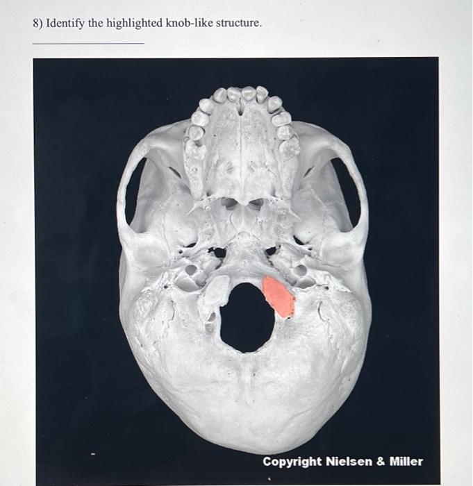 Solved 8) Identify the highlighted knob-like structure. | Chegg.com