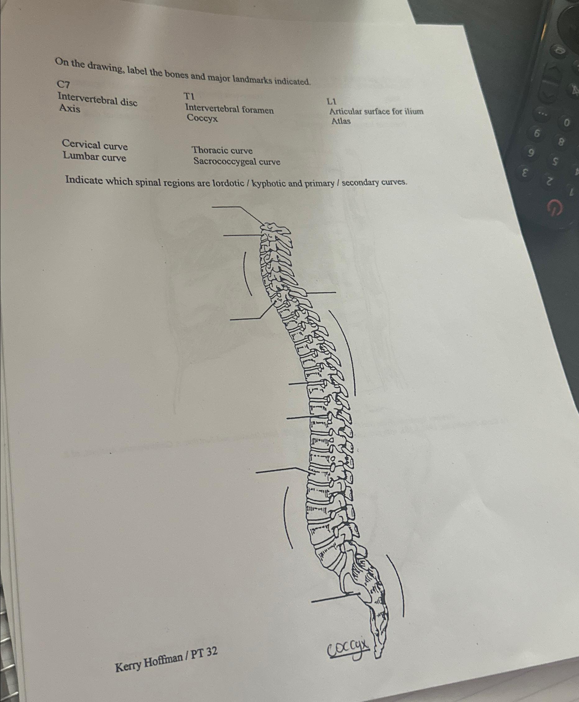 Solved On the drawing, label the bones and major landmarks | Chegg.com