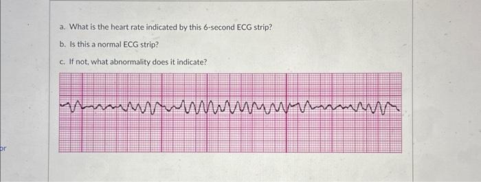 a. what is the heart rate indicated by this 6 second | Chegg.com