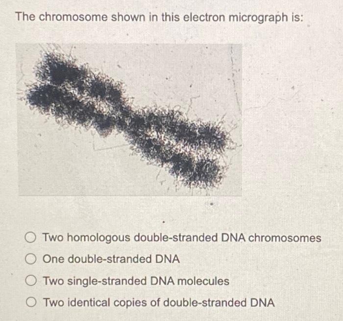 Solved The chromosome shown in this electron micrograph is: | Chegg.com